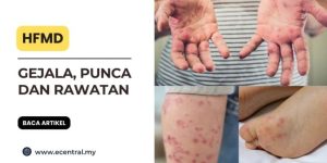 Tanda & Cara Merawat HFMD Dengan Cepat Simptom Terkini